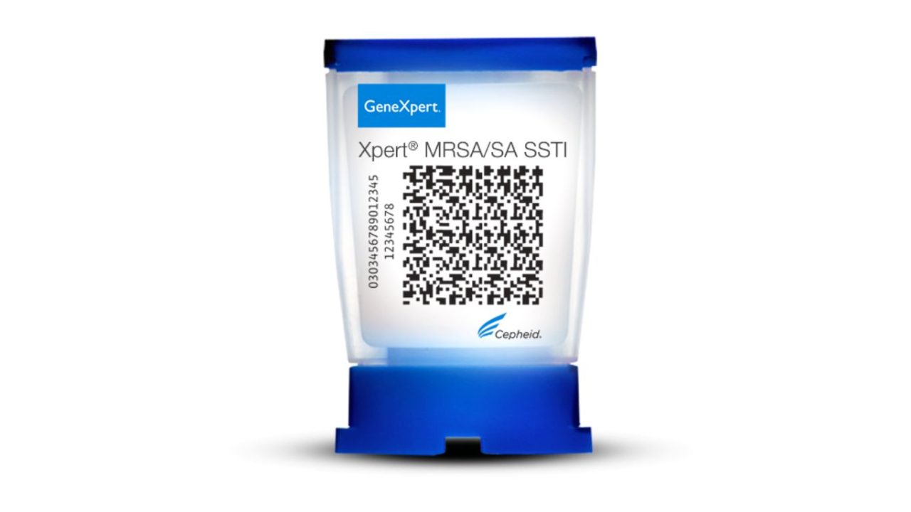 Tes Cepat Molekuler (TCM) Deteksi MRSA