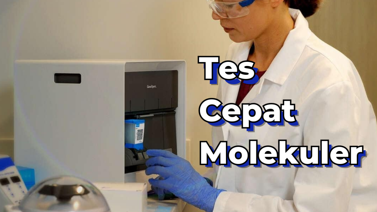 Tes Cepat Molekuler (TCM) Solusi Pemerintah RI Menangani TB