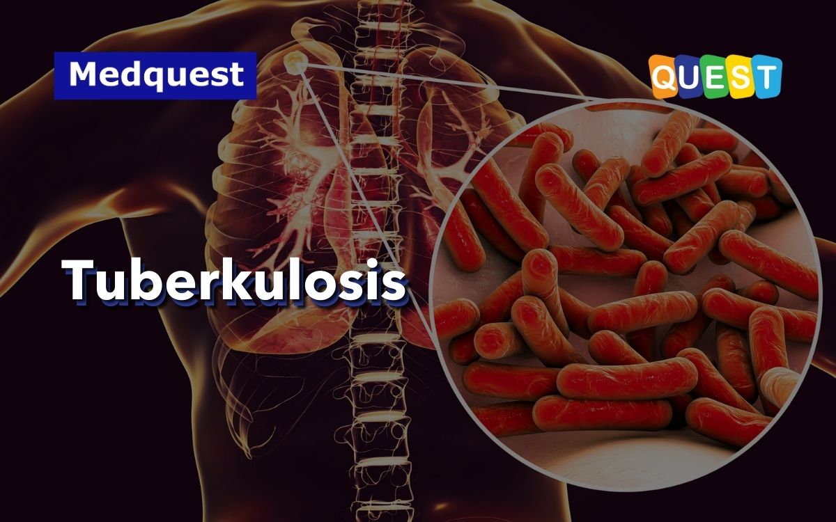 Tuberkulosis: Penyebab, Gejala dan Cara Penyembuhan