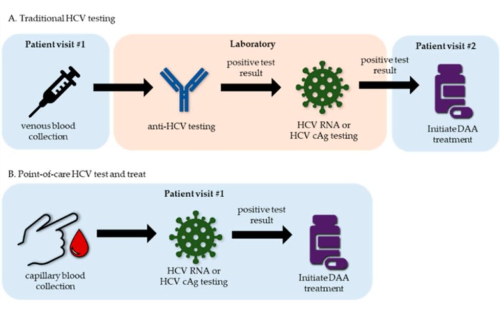 Eradikasi Hepatitis C: Pentingnya Peran Pemantauan RNA HCV