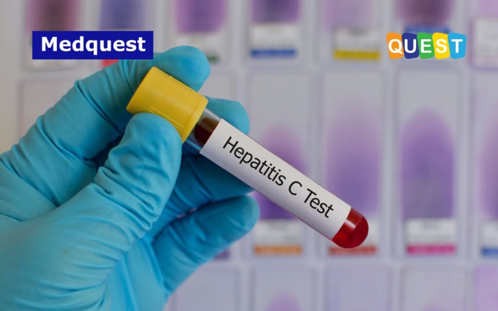 Hemex Gazelle - PT Medquest Jaya Global