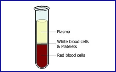 8 Fungsi Plasma Darah & Kasus yang Membutuhkan Transfusi Plasma Darah