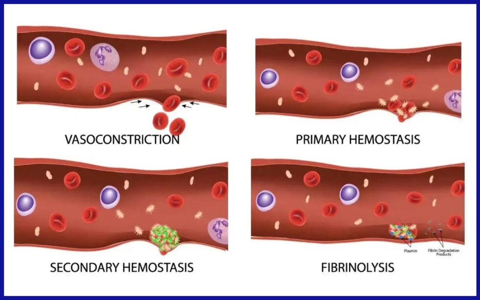 Tromboelastografi: Solusi Pemeriksaan Fungsi Hemostasis