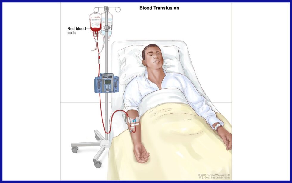 Mengenal Transfusi Darah: Manfaat, Proses, dan Risikonya